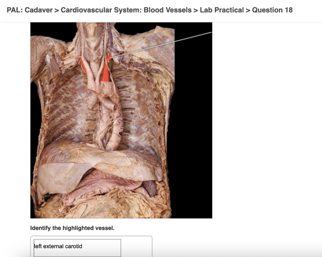 Solved PAL: Cadaver > Cardiovascular System: Blood Vessels > | Chegg.com