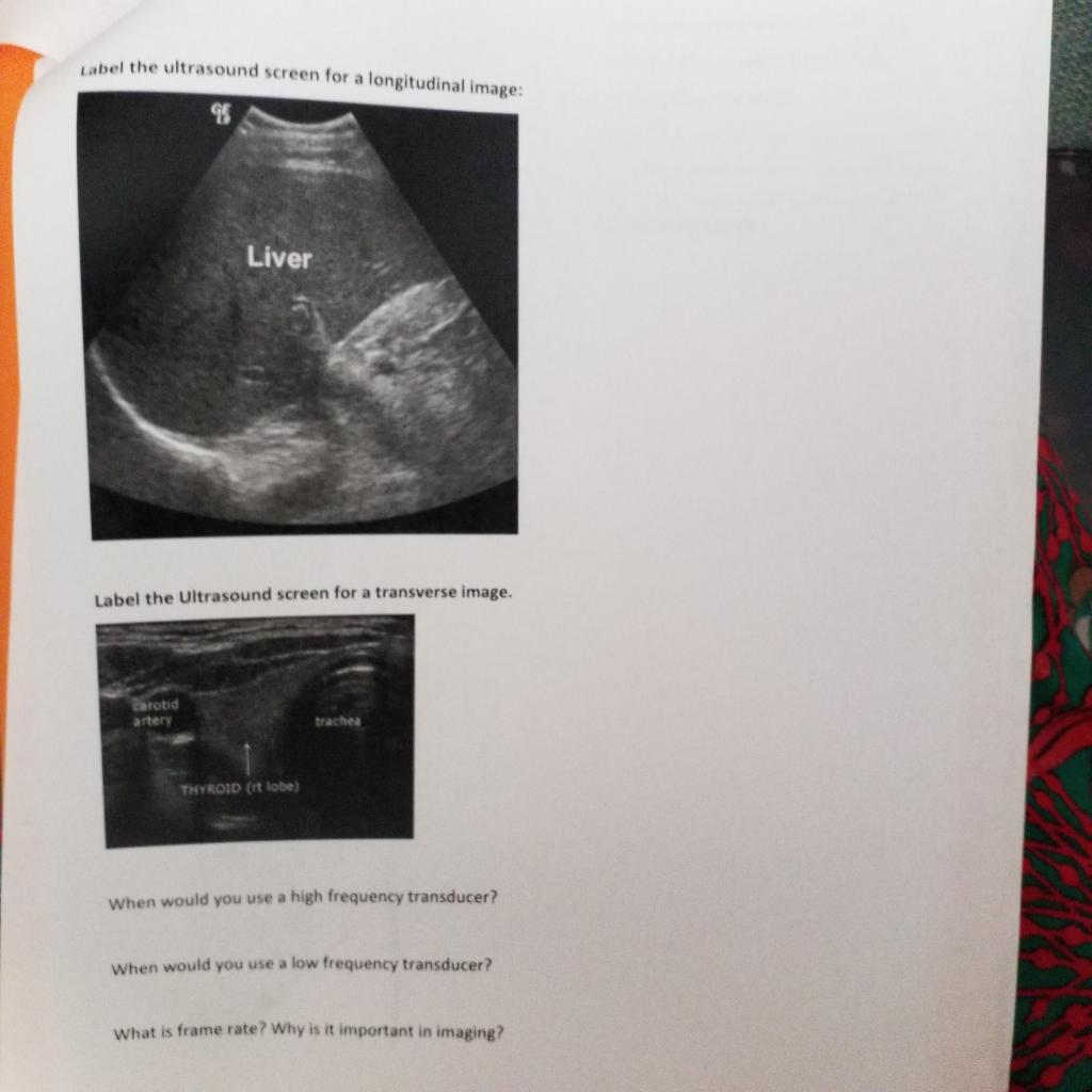 [Solved]: tabel the ultrasound screen for a loneitudinat i