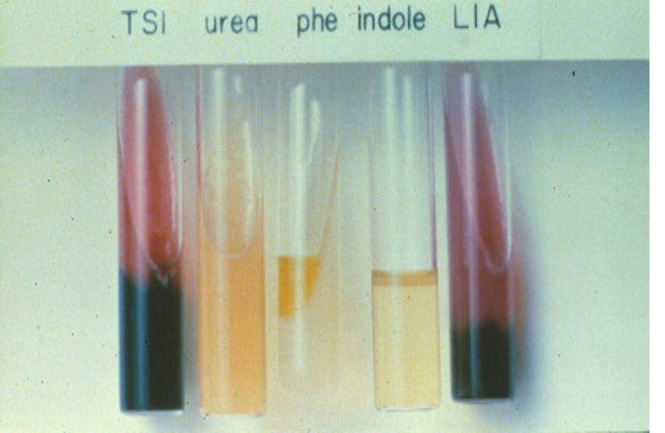 Solved TSI urea phe indole LIA | Chegg.com