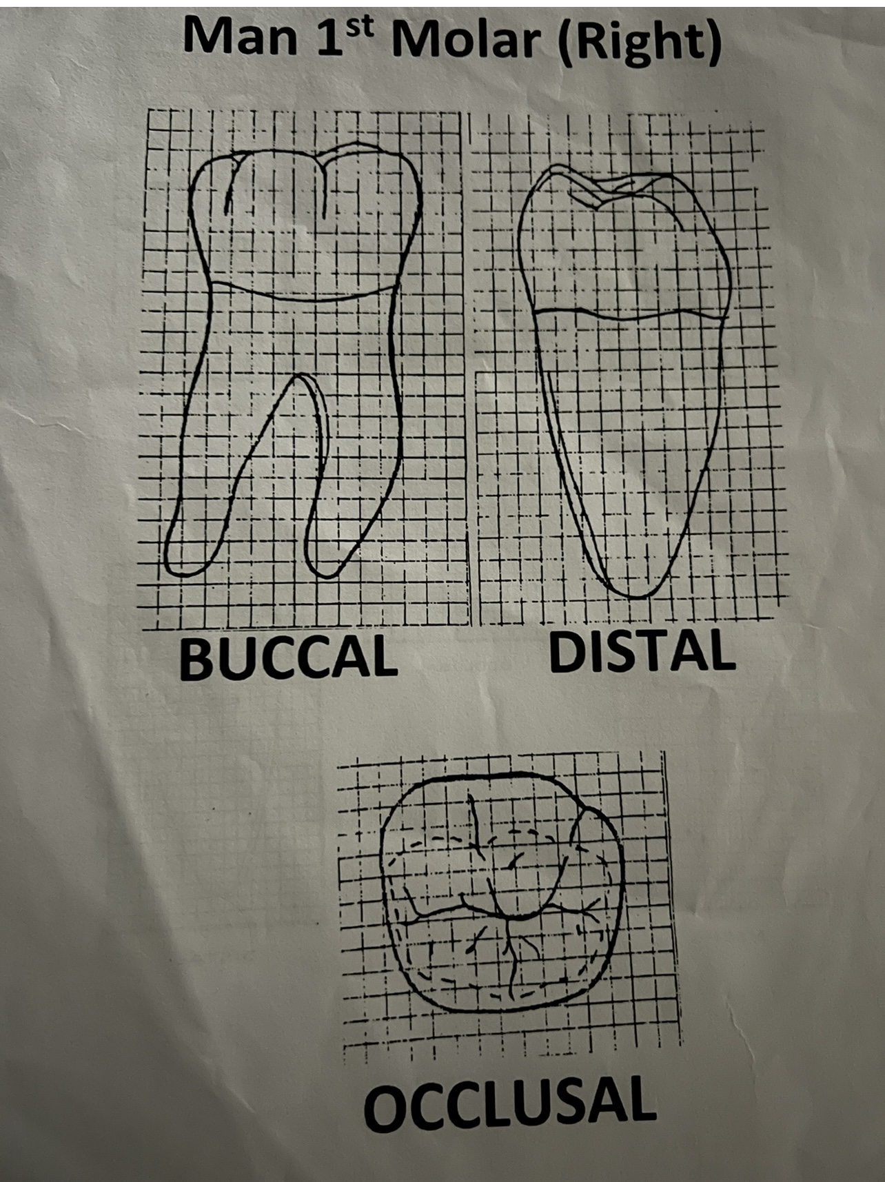 [Solved]: My question is what are the five aspects for tooth