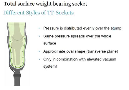 Total Surface Bearing Socket