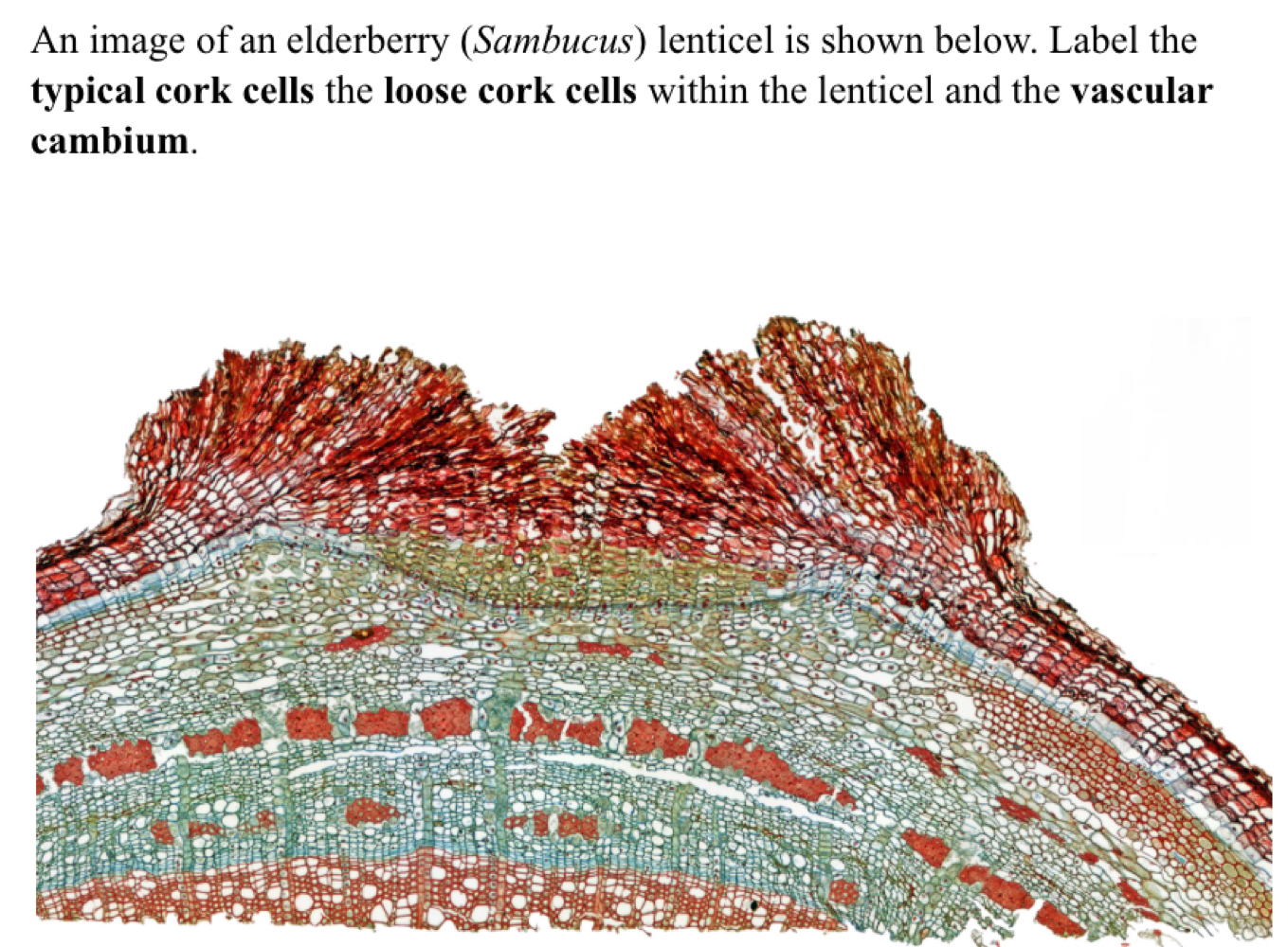 Solved An image of an elderberry (Sambucus) lenticel is | Chegg.com