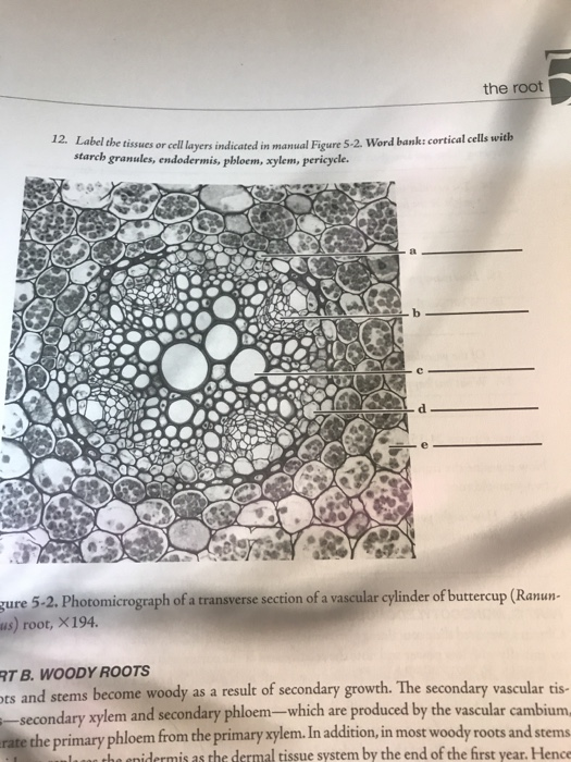Solved the root 12. Label the tissues or cell layers | Chegg.com