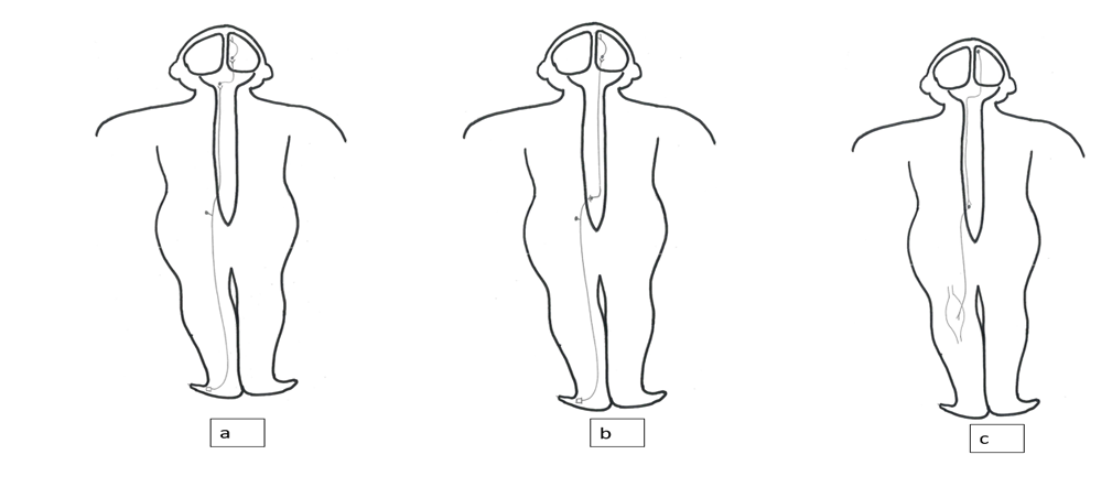 Solved Which image of neural pathway (a), (b) or (c) would | Chegg.com