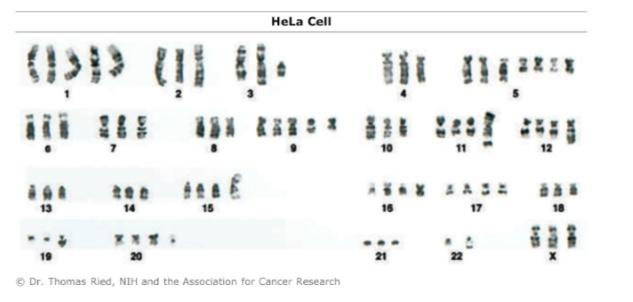 Solved Figure 1 – Normal Human Genome Figure 2 – HeLa | Chegg.com