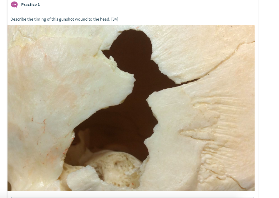 Solved Practice 1 Describe the timing of this gunshot wound | Chegg.com