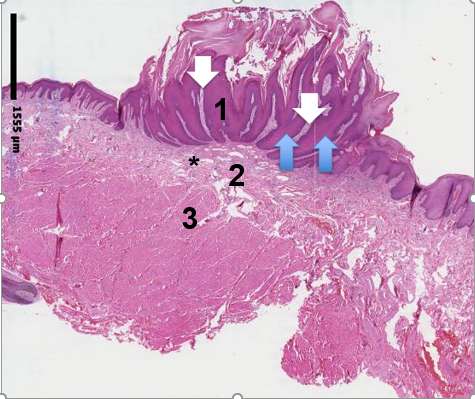 Solved This is a slide of a wart under magnification 1. What | Chegg.com