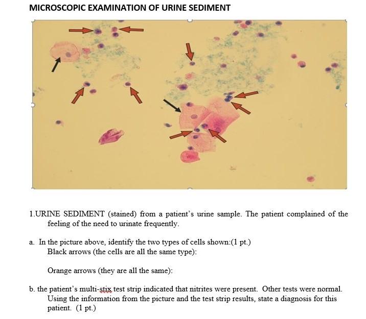 Solved MICROSCOPIC EXAMINATION OF URINE SEDIMENT 1.URINE | Chegg.com
