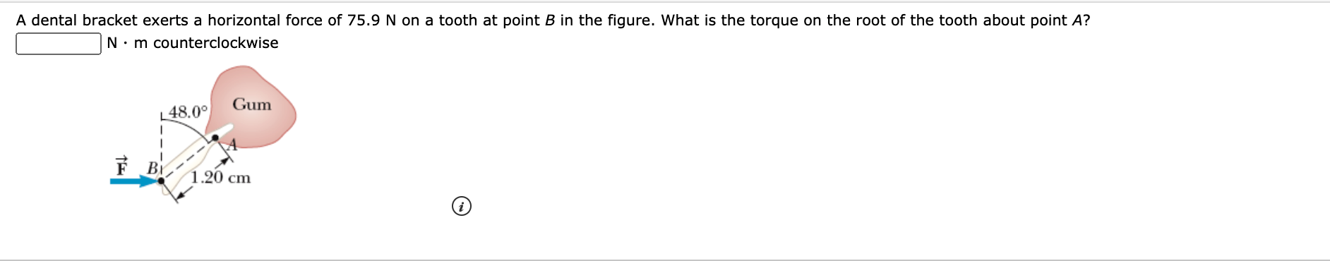 Solved A dental bracket exerts a horizontal force of 75.9 N | Chegg.com