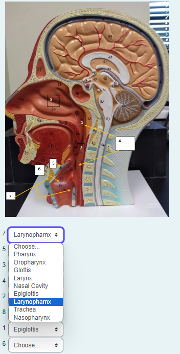 Solved Need help identifying Respiratory system structures | Chegg.com