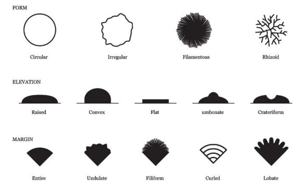 Solved BIN COUGH A swab from a trash bin spread directly | Chegg.com