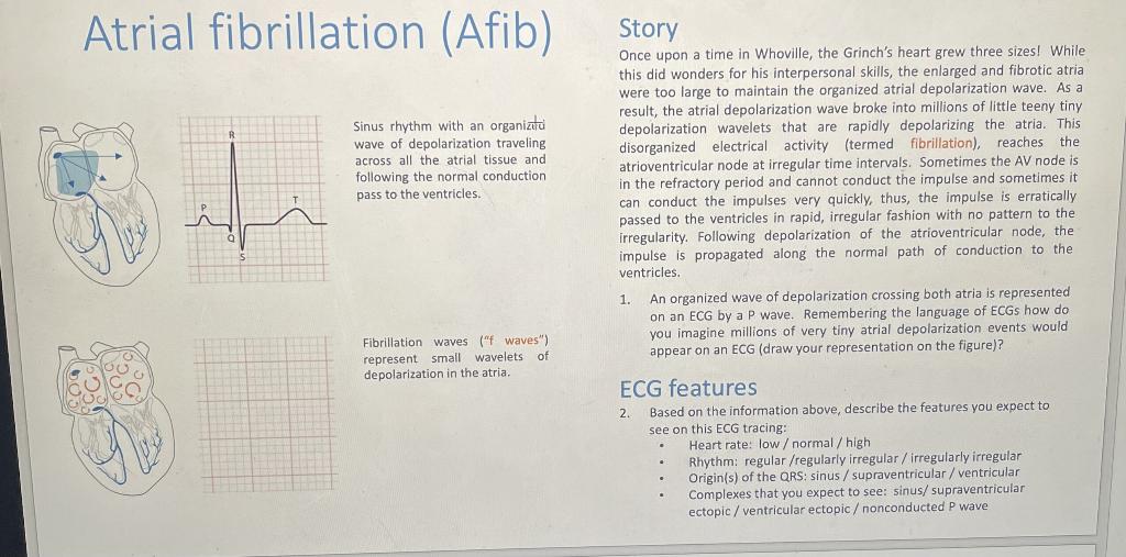 Solved Atrial fibrillation (Afib) Story Once upon a time in | Chegg.com