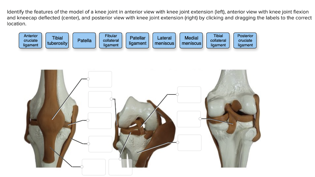 Solved Identify the features of the model of a knee joint in | Chegg.com