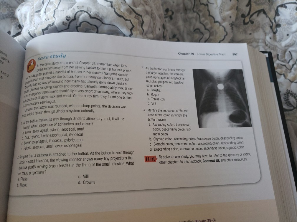 Solved Chapter 39 Lower Digestive Tract 897 pance- case | Chegg.com