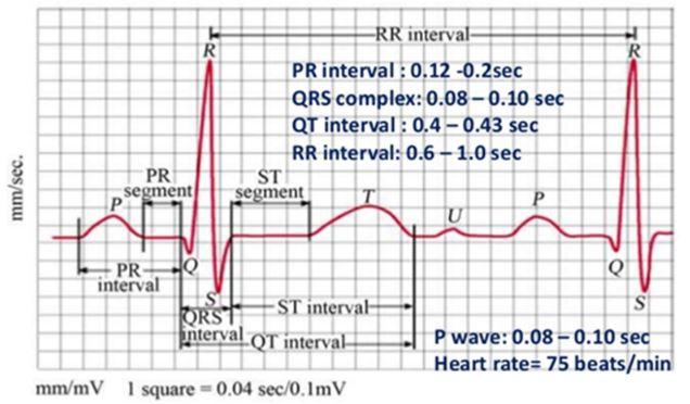 The heart record or ECG is one of the most important | Chegg.com