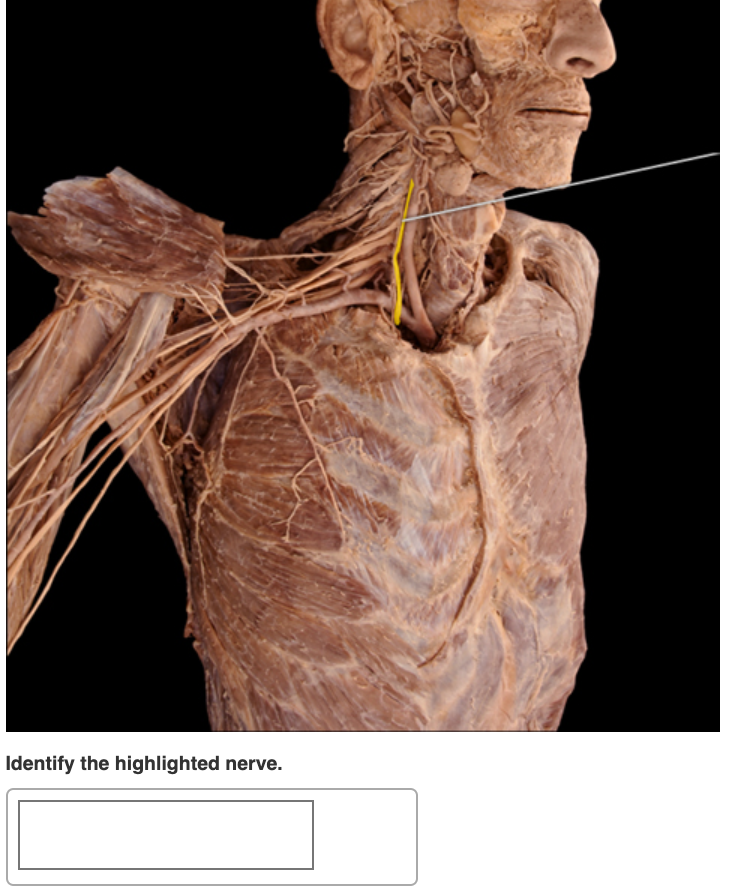 Solved Identify the highlighted nerve. Identify the | Chegg.com
