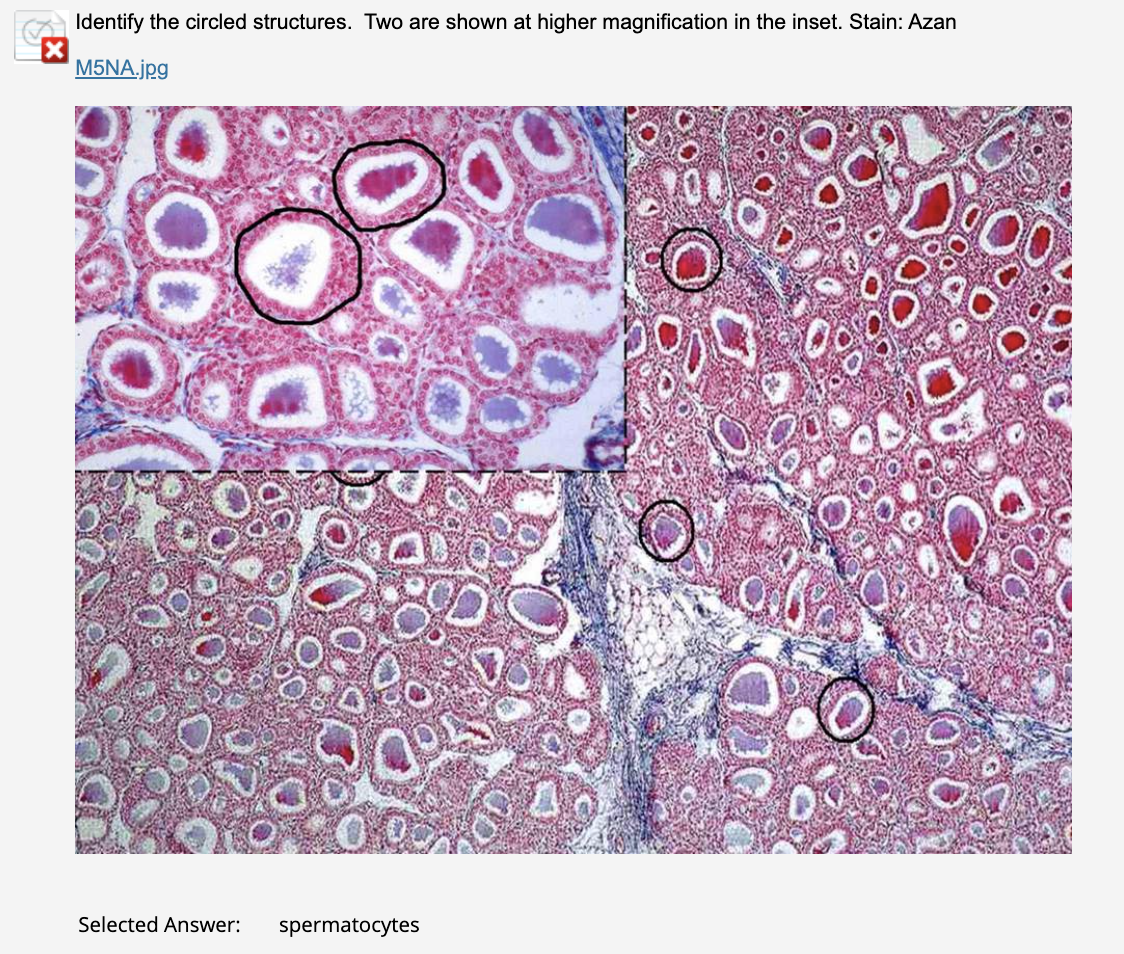 Solved Identify the circled structures. Two are shown at | Chegg.com
