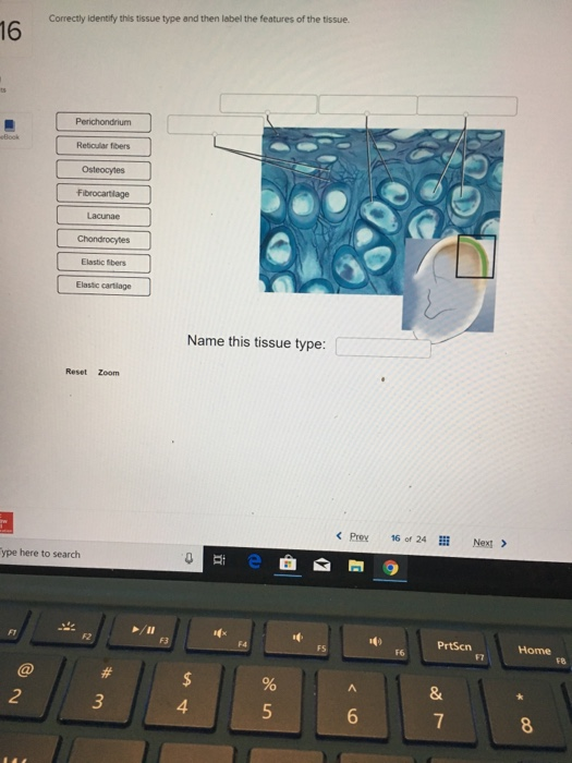 Solved Correctly identify this tissue type and then label | Chegg.com