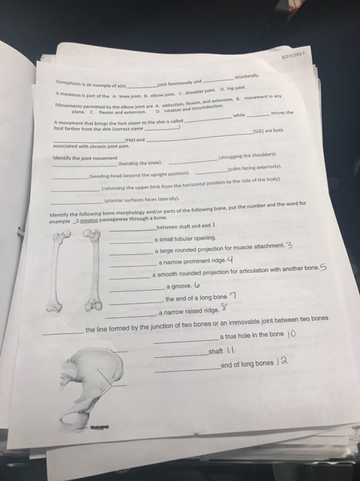 Solved Gomphosis is an example of _________ joint | Chegg.com