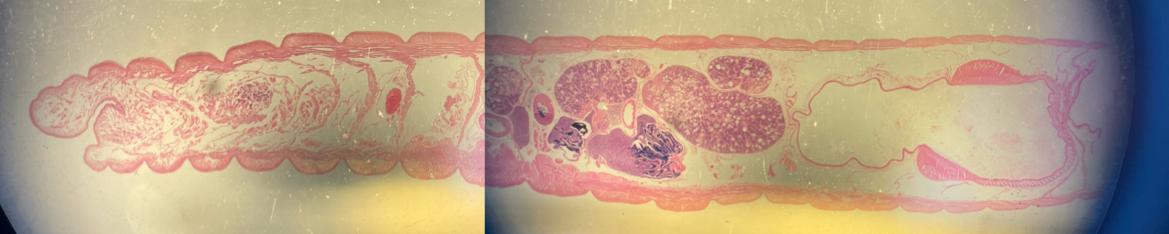 Solved Label this longitudinal section of an earthworm with: | Chegg.com