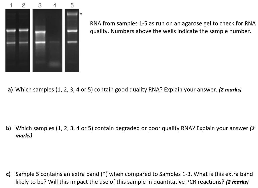 Solved Once RNA is extracted from animal tissue, it is run | Chegg.com