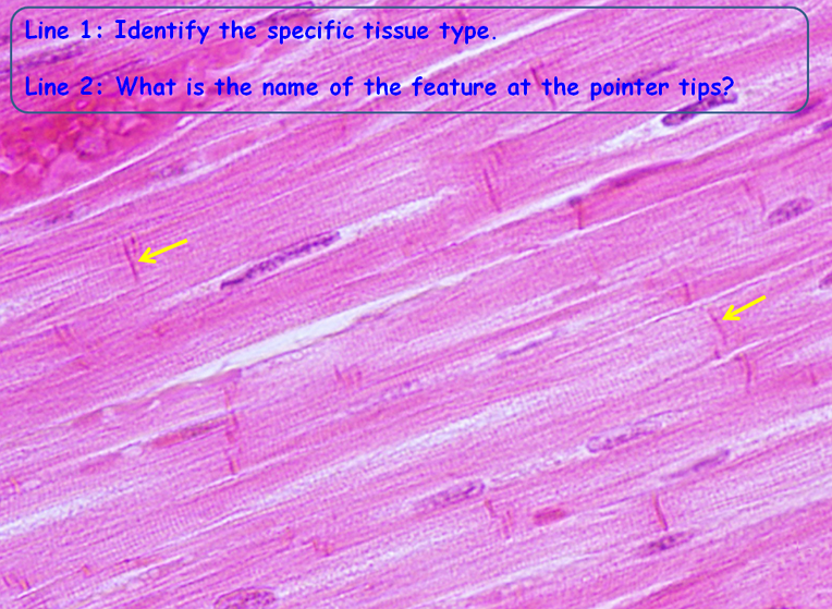Solved Line 1: Identify the specific tissue type. Line 2: | Chegg.com