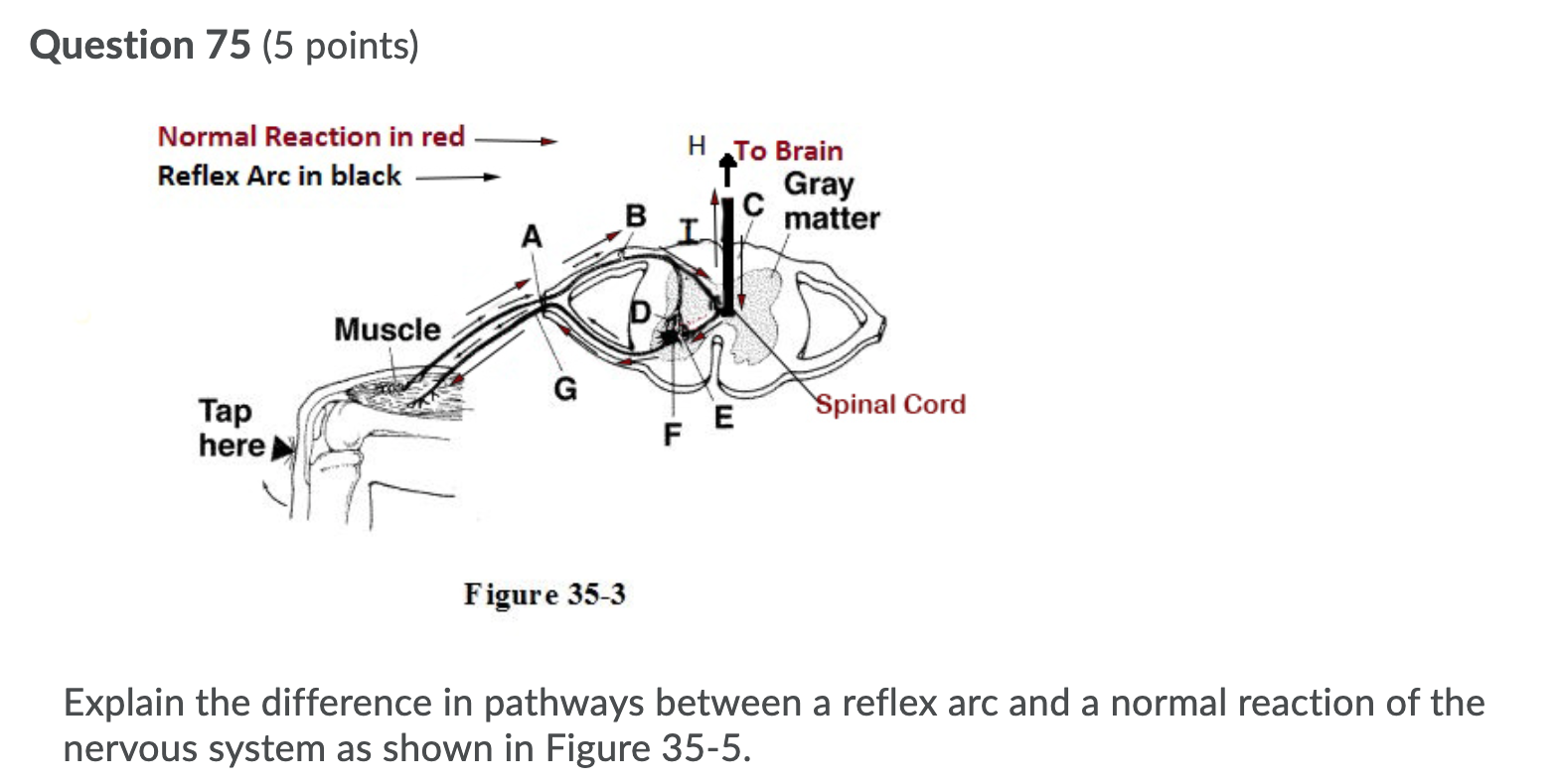Solved Question 75 (5 points) Normal Reaction in red Reflex | Chegg.com