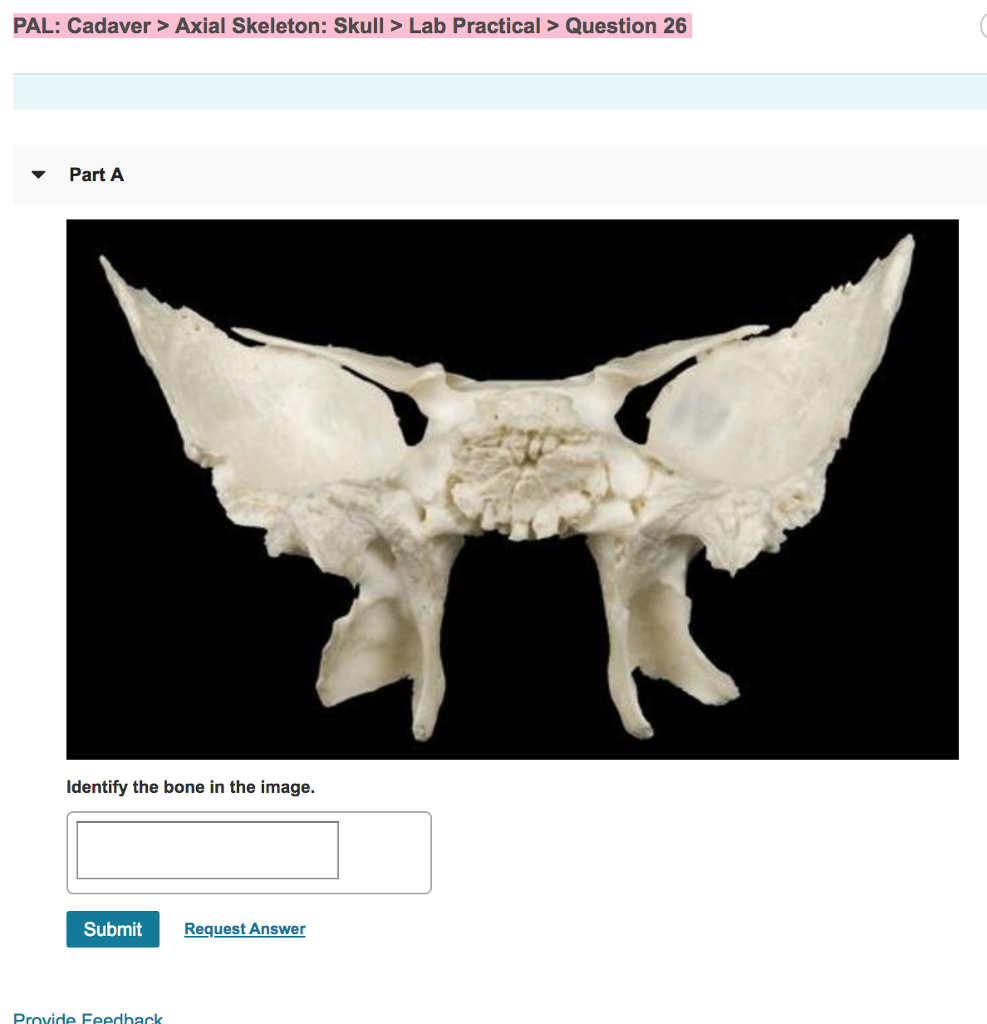 Solved PAL: Cadaver>Axial Skeleton: Skull>Lab | Chegg.com