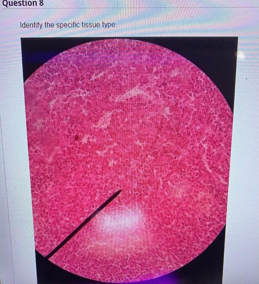 Solved Question 8 Identify the specific tissue type | Chegg.com