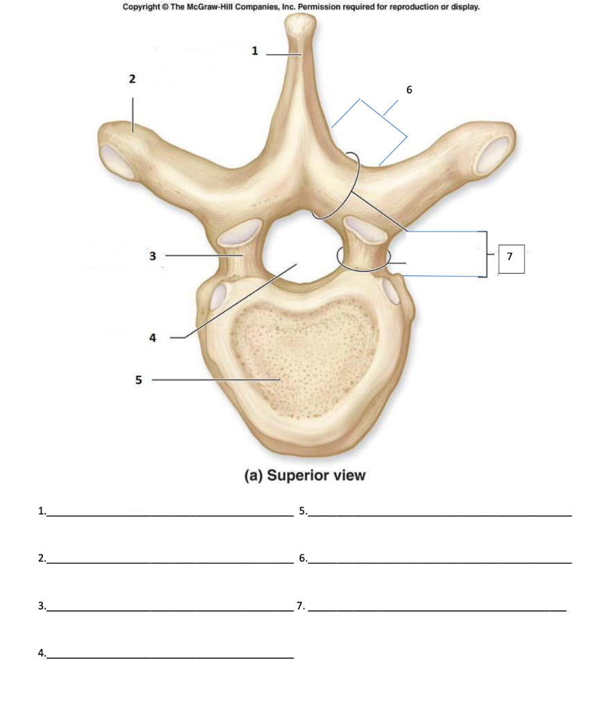 Solved Fill in the blanks for the skull, thorax, spine, | Chegg.com