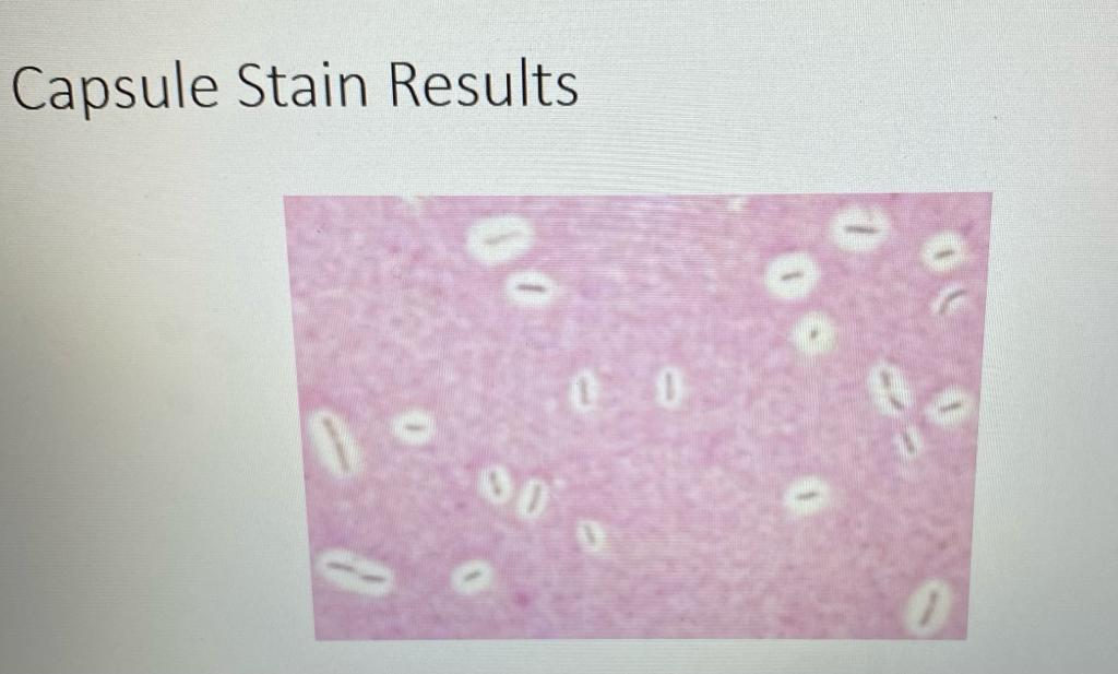 Capsule Stain ResultsIdentification Chart for | Chegg.com