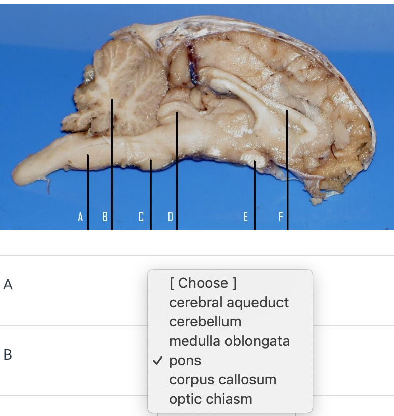 Solved Identify the structures A-F using the options in the | Chegg.com