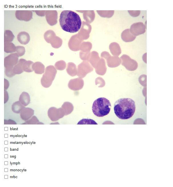 Metamyelocyte Vs Monocyte
