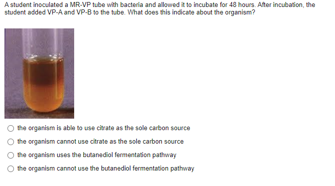 Solved A student inoculated a MR-VP tube with bacteria and | Chegg.com