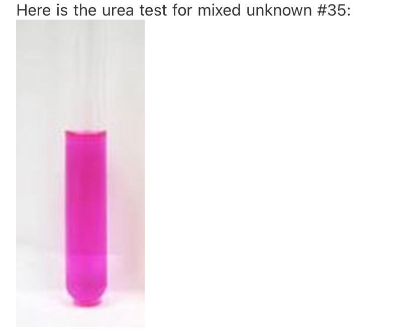 Solved Here is the gram stain for mixed unknown \#35: Here | Chegg.com