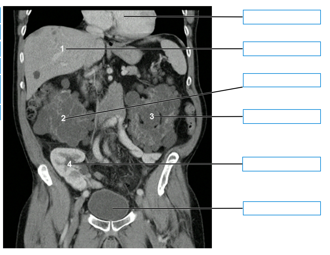 Solved Label the features on this computerized tomography | Chegg.com