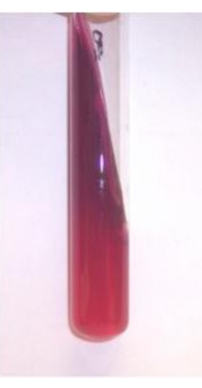 Solved What are the results for the TSI test in the picture | Chegg.com