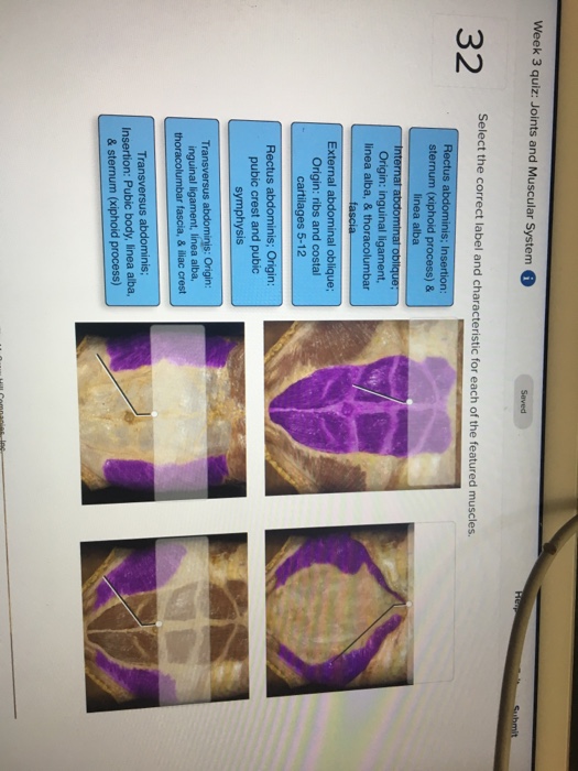 Solved: Week 3 Quiz: Joints And Muscular System Select The... | Chegg.com Solved: Week 3 Quiz: Joints And Muscular System Select The... | Chegg.com