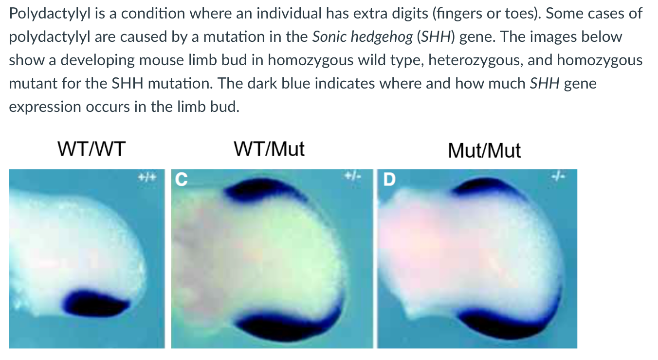 Solved Polydactylyl is a condition where an individual has | Chegg.com