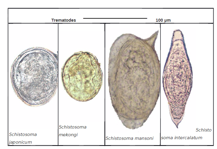 Solved Trematode Eggs Found in Stool Specimens of Humans | Chegg.com