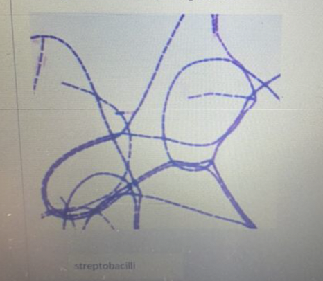 Solved What is the arrangement of Bacillus anthracis, in | Chegg.com