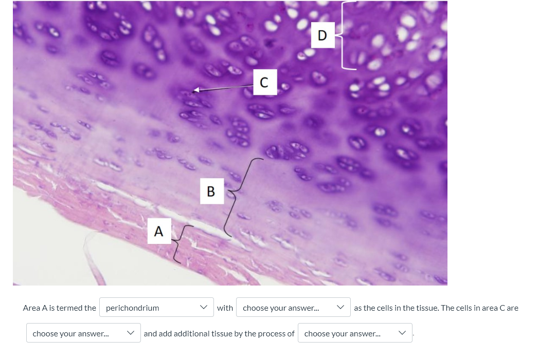 Solved A choices: Perichondrium, lacuna, lamellae, | Chegg.com