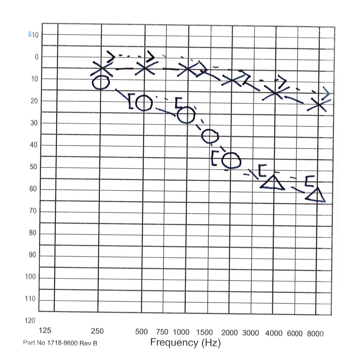 Solved Based on the audiogram above, you record an SRT for | Chegg.com