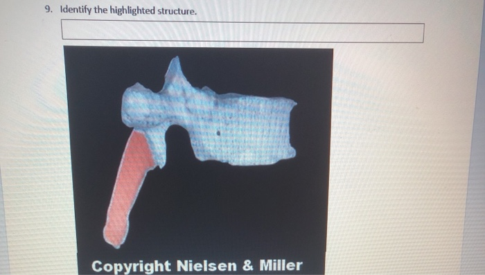 Solved 9. Identify the highlighted structure. Copyright | Chegg.com