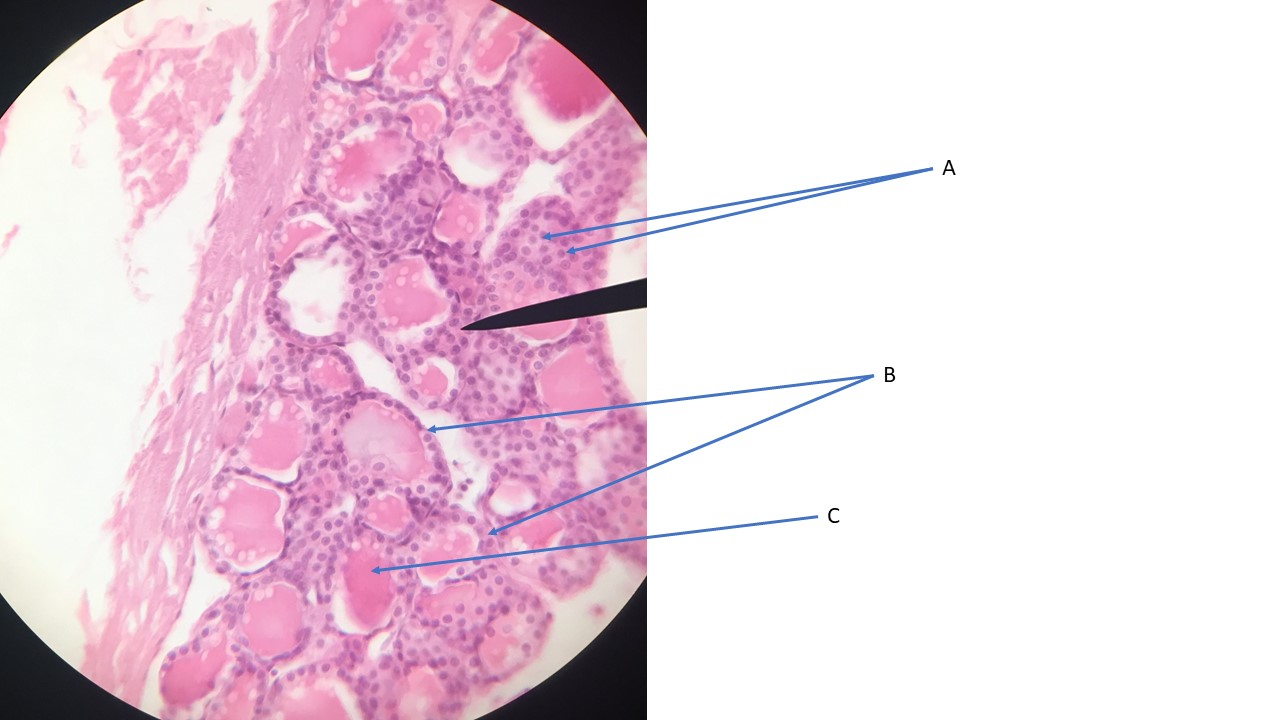 Solved Answer the questions for the following pictures (a) | Chegg.com