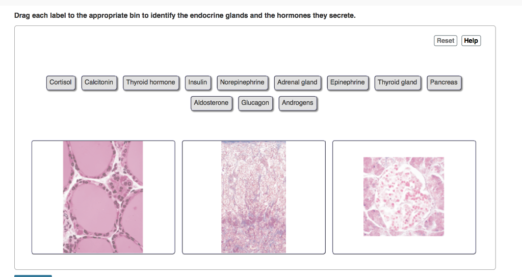 Solved Drag each label to the appropriate bin to identify | Chegg.com