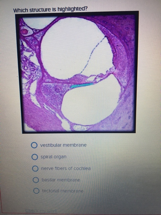 Solved Which structure is highlighted? vestibular membrane | Chegg.com