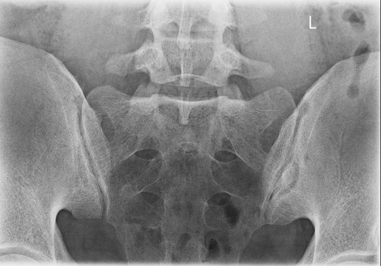 Solved Locate the left L3 pars interarticularis Locate the | Chegg.com
