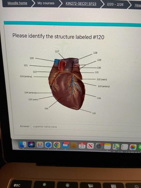 Solved Please identify the structure labeled \#120 | Chegg.com