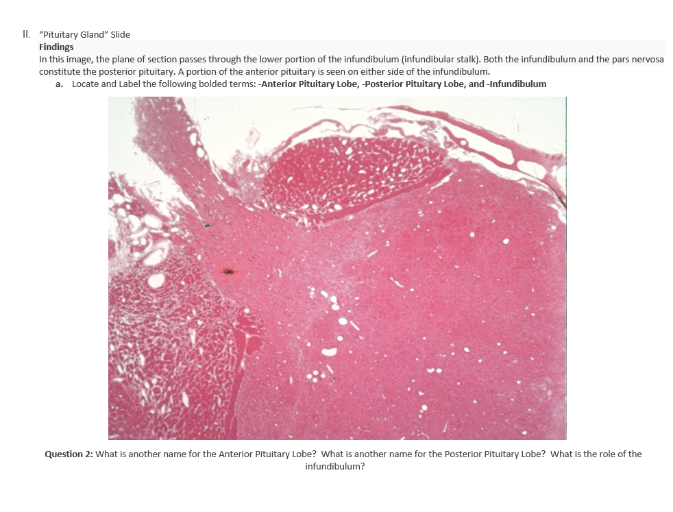 II. "Pituitary Gland" Slide Findings In this image, | Chegg.com